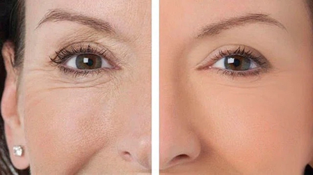 “Collogen” Regenerative Night Cream