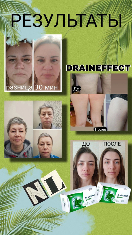 Драйн эффект нл интернейшнл