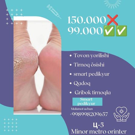 Smart pedikyur va hijoma boyicha shogrt olamiz Podalogiya orgariladi