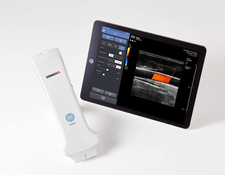 Портативный УЗИ-сканер Кареские Healcerion Sonon 300L