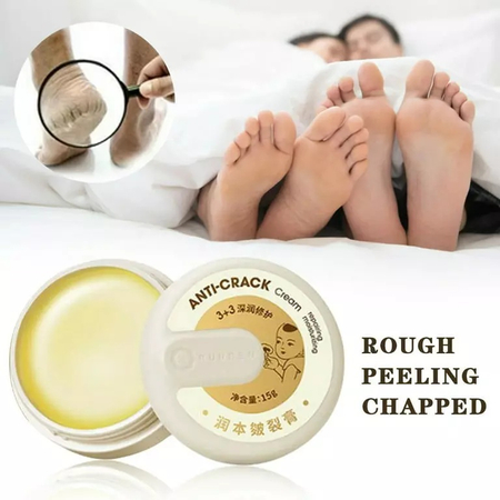Anti crack cream