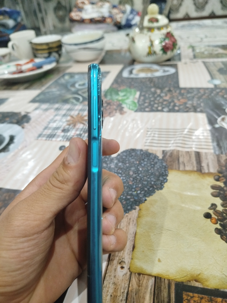 Redmi not 9 pro Aybi orqasi singan boshqa aybi yo