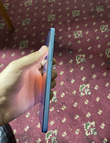 Redmi Not 11 xolati yaxshi