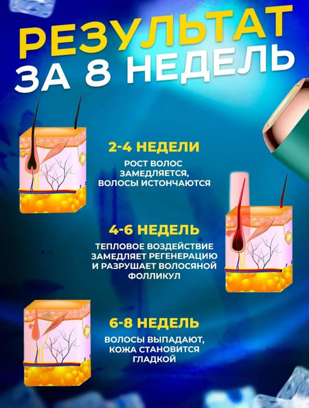 Улучшенная новинка фотоэпилятор профессиональный