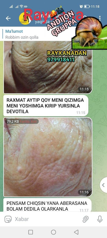 Yuzdagi ajinlarni ketkizuvchi nabor