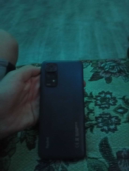 Redmi note 11s aybi umuman yoq