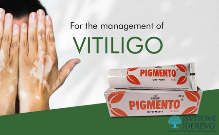 Pigmento, Пигменто маз,витилиго учун