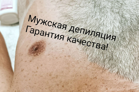 Депиляция для мужчин