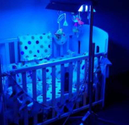 Fototerapiya chaqaloqlar uchun lampa arendaga beriladi.