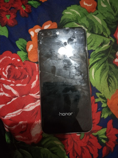 Honor x9 lite sotiladi