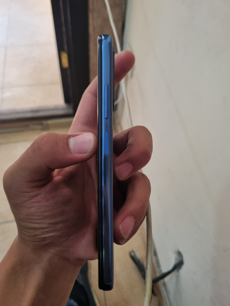 Redmi note 11 xolati zor