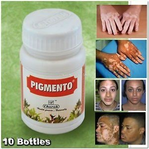 Pigmento Теридаги окдогларни ёкотадиган  ВИТИЛИГО касалигни  Жиззах