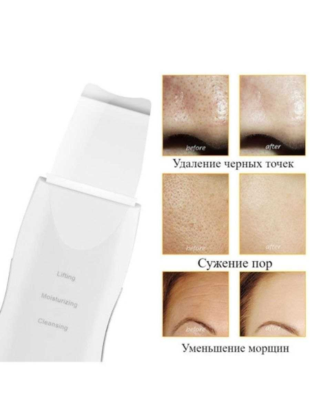 Ультразвуковая машина для чистки лица