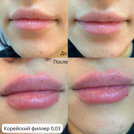 Косметолог для женщин