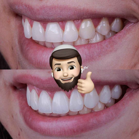 Stomatologiya  hizmati sifatli  hamyonbob xizmatini taklif qilamiz