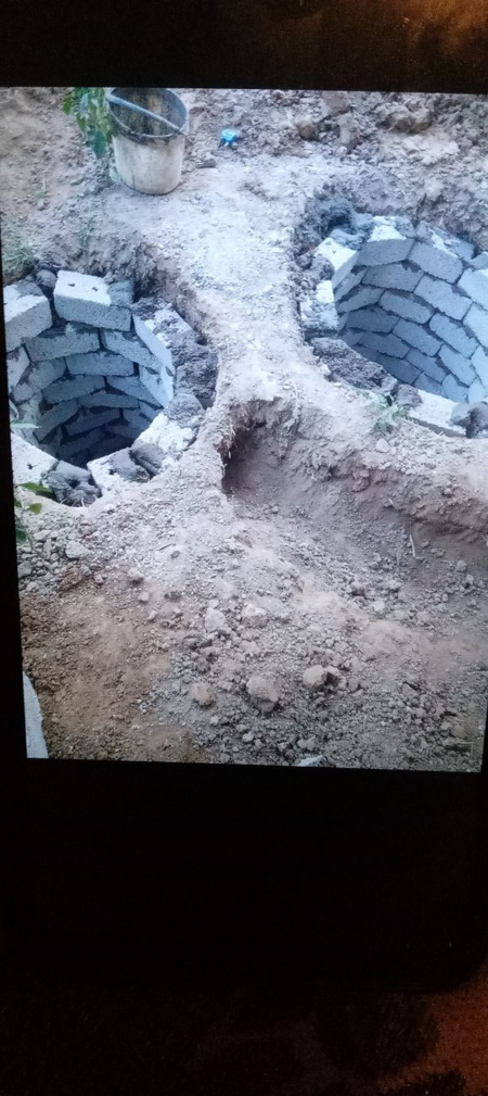 Urachi arzon narxlarda bajaramiz