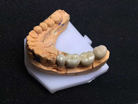 Зуботехническая услуги и материалы для CAD/CAM - DENTAL