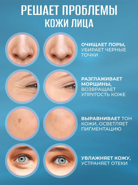 Ультразвуковая чистка лица аппарат,от черных точек