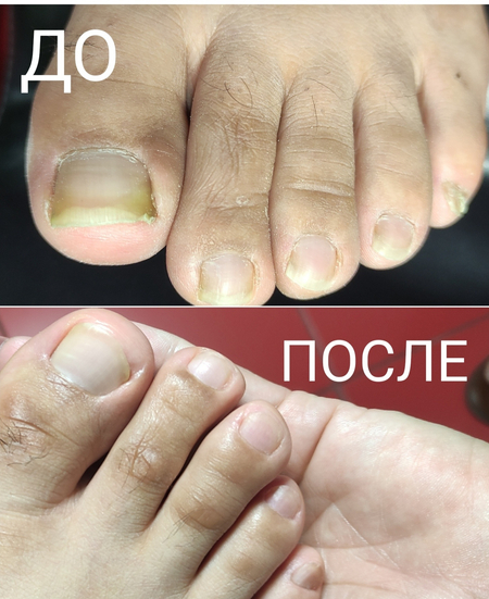 Мужской маникюр/педикюр
