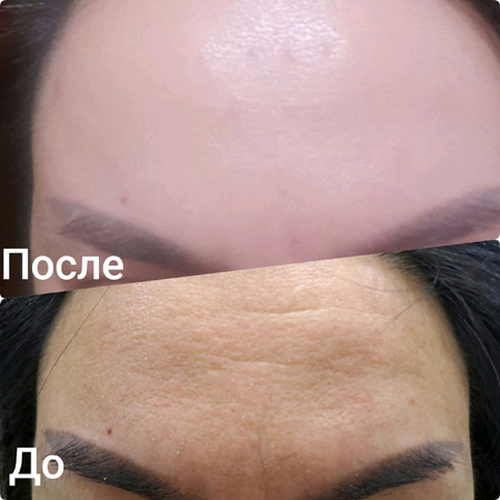 Kosmetolog 50% skidka
