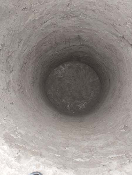 Urachi oʻra tiranshiya padval basin qaziymiz urachi