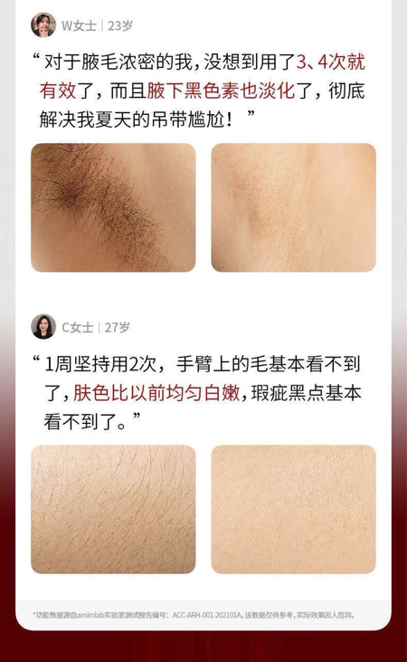 Lazer epilator Amiro