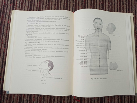 Основы Китайской Акупунктуры. Иглоукалывание.