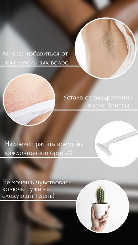 Лазерная эпиляция