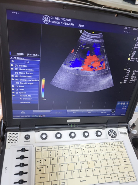 GE Logiq e  
Cardio, Convex, Linear 
Реальное состояние!