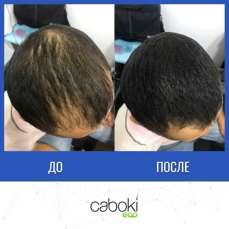 Сочни қалинлаштирувчи Caboki 25 g. | Доставка бепул