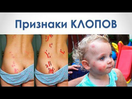 Dezinfeksiya Дезинфекция dezenfeksiya дезинсекци dezinfeksia