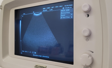 Аренда! УЗИ аппарат Mindray DP-1100Plus 
Портативный УЗИ а