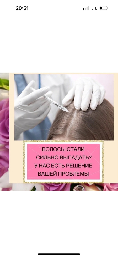 Лечение выпадения волос