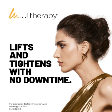 Ultherapy HIFU (SMAS-Lifting)