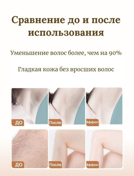 Фотоэпилятор новый