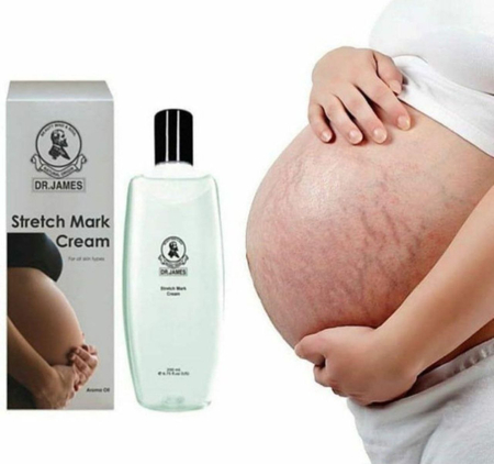 Stretch Mark cream - Крем против растяжек