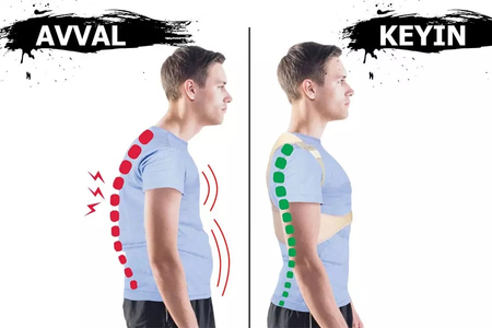 yelka va umurqadagi qiyashishni toʻgʻirlash uchun sport posture