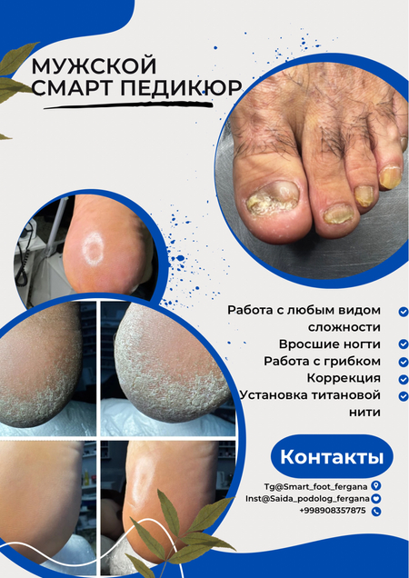 Подолог Смарт педикюр