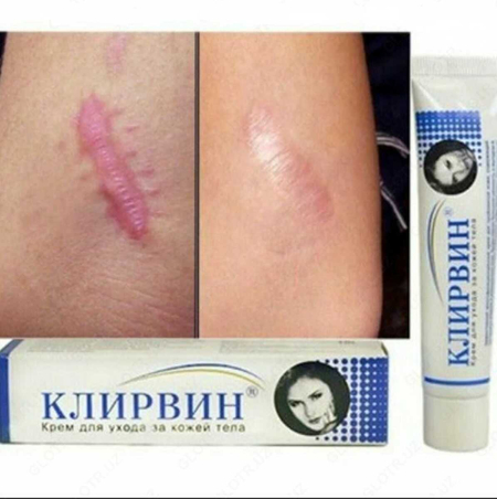 Клирвин крем от прыщей и шрамов