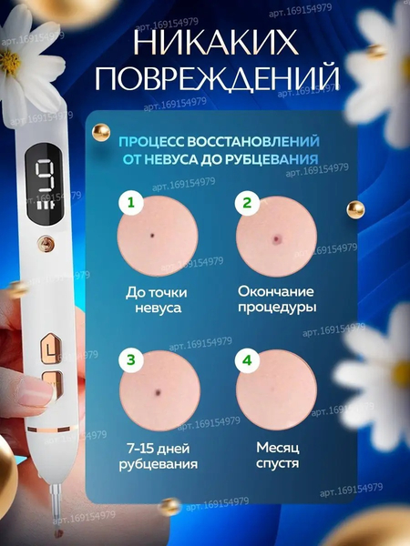 Лазерная ручка от папиллом и бородавок. Коагулятор